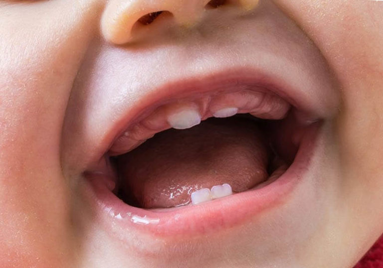 When Do Baby Teeth Come In? All You Ever Wanted To Know — Caring ...